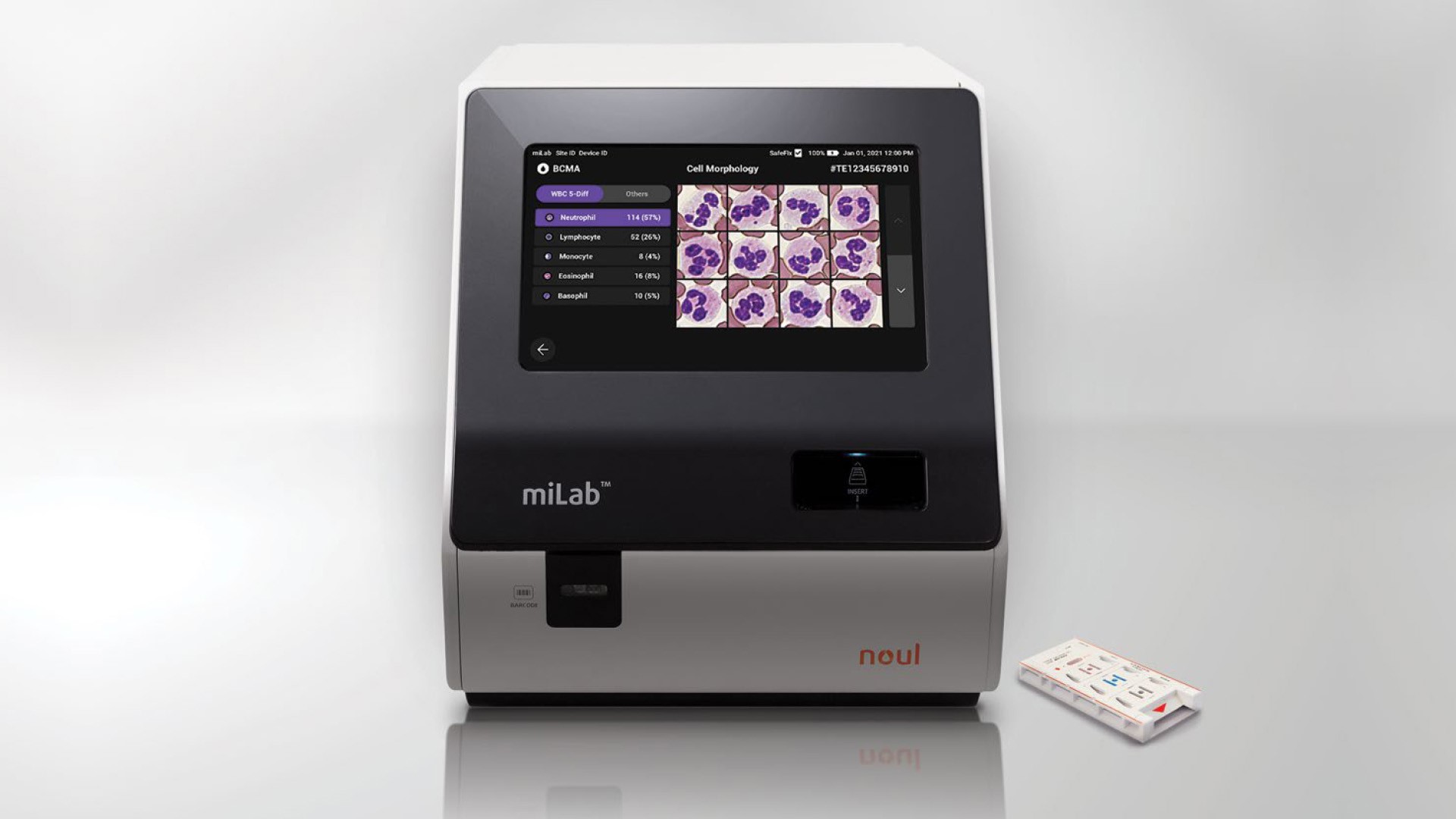 miLab KI-Diagnoseplattform - KREIENBAUM Neoscience